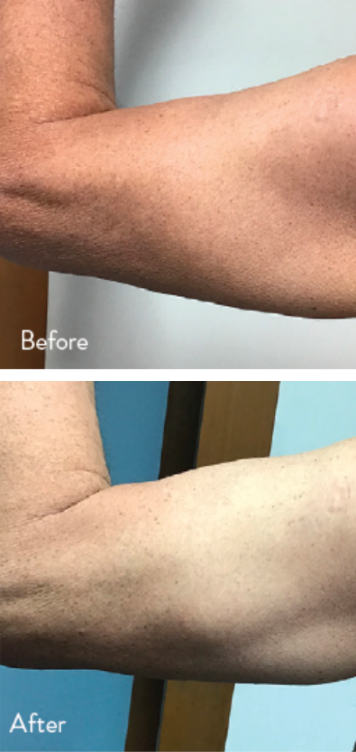 Introducing Evolve Transform! All In One Body Sculpting - the IV health ...